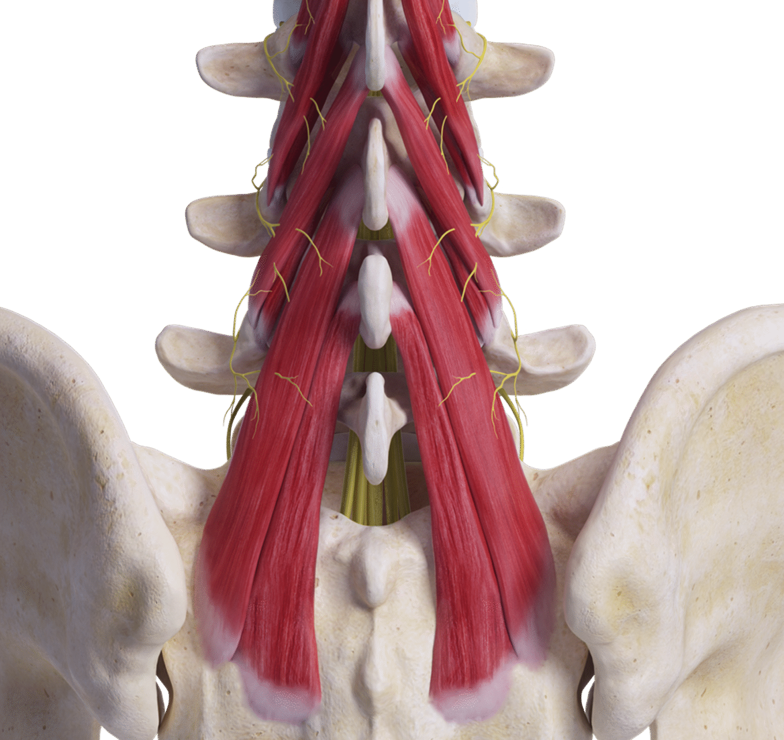 Pros and Cons of RFA in Treating Chronic Low Back Pain - Mainstay Medical