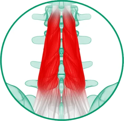 ReActiv8-Me - Mainstay Medical